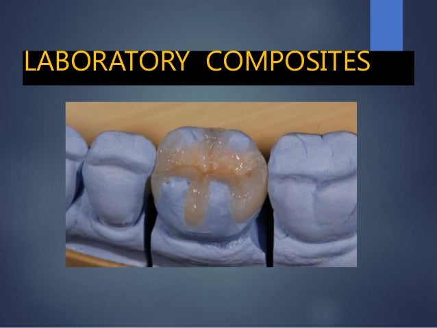 Recent advances in Dental Composites | PPTX