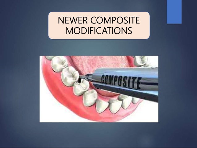 Recent advances in Dental Composites | PPTX