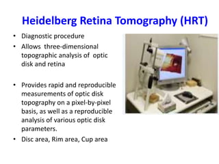 Recent advances in diagnosis of glaucoma | PPTX