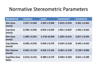 Recent advances in diagnosis of glaucoma | PPTX
