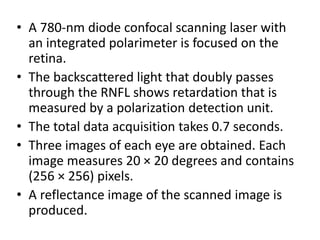 Recent advances in diagnosis of glaucoma | PPTX