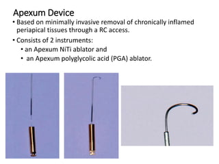 Recent advances in endodontics | PPTX
