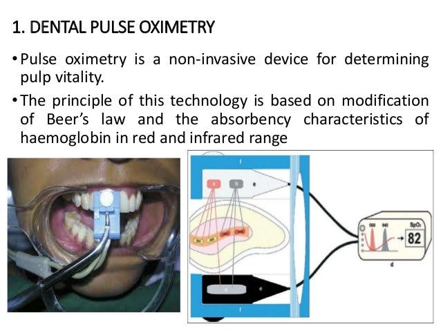 Recent advances in endodontics