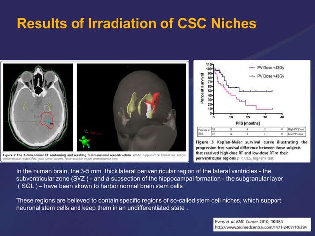Recent advances in Glioblastoma Multiforme Management | PPTX