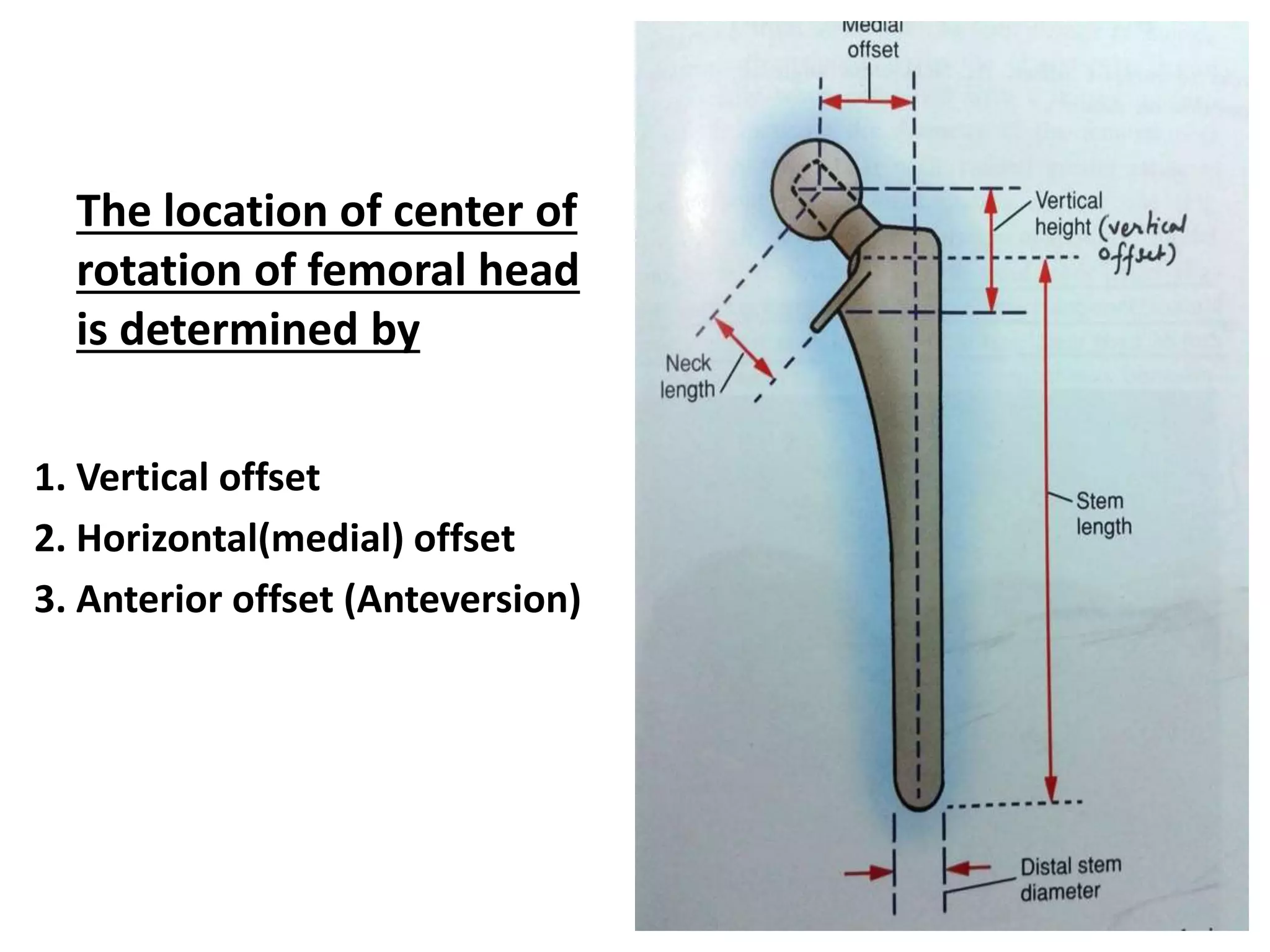Recent advances in joint arthroplasty | PPTX