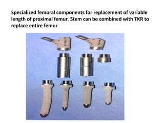 Recent advances in joint arthroplasty | PPTX