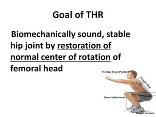 Recent advances in joint arthroplasty | PPTX