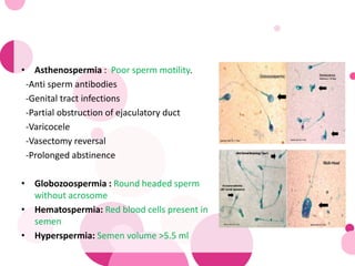 Recent advances in male infertility | PPT