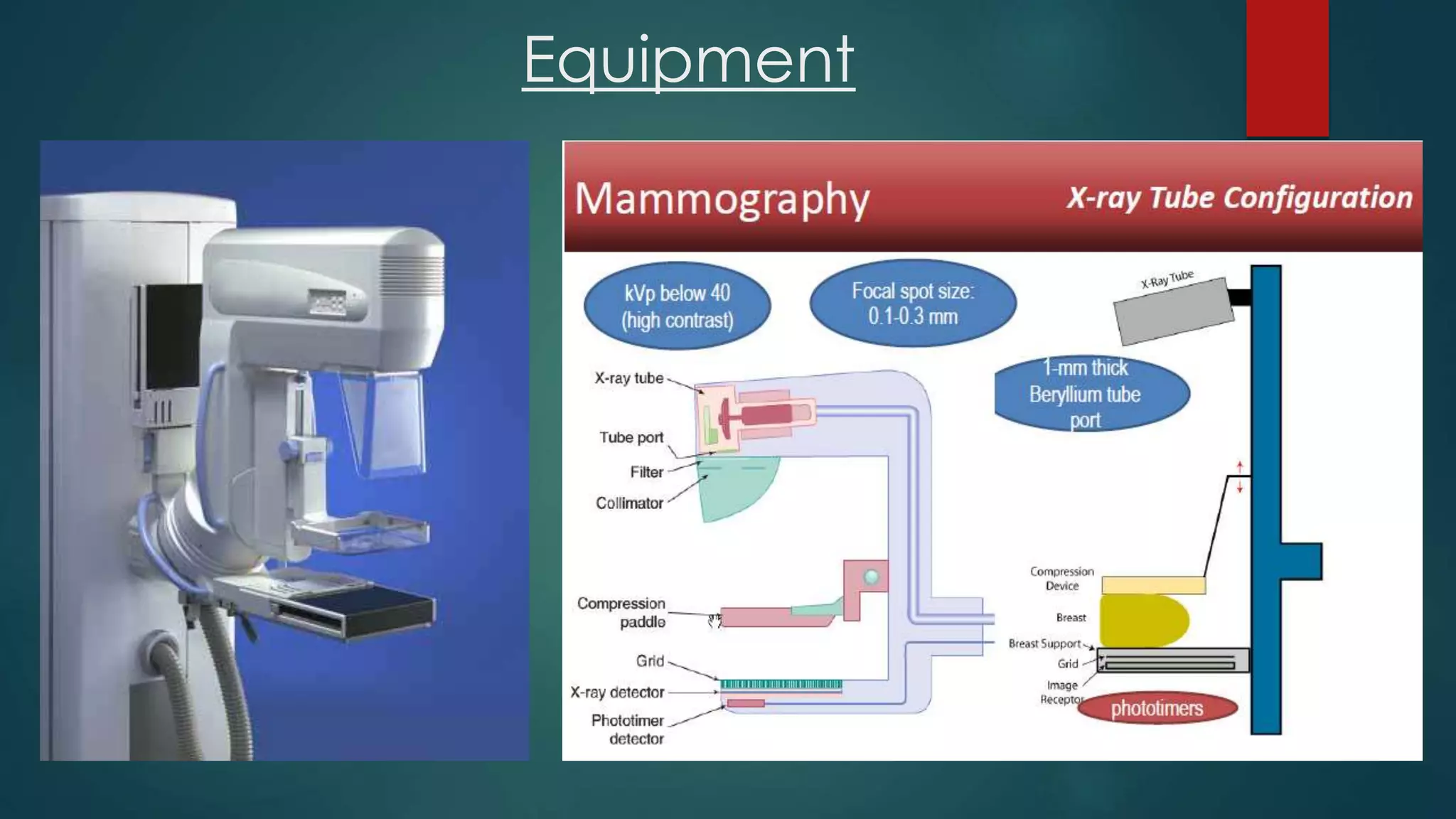 Recent advances in Mammography | PPTX