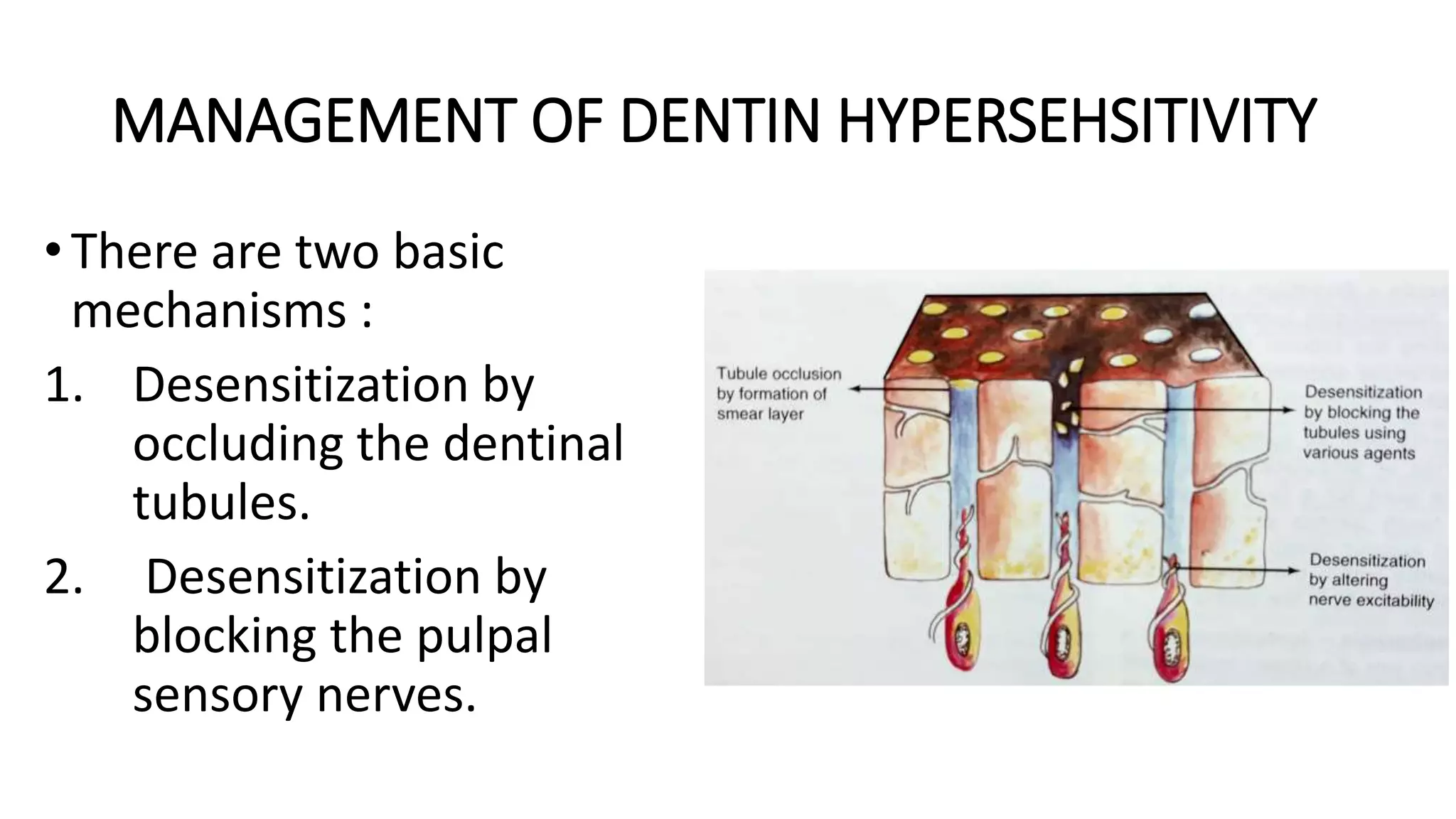 Recent advances in management of dental hypersensitivity | PPTX