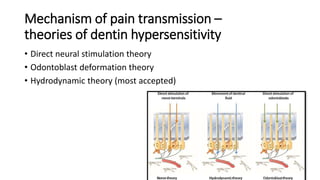 Recent advances in management of dental hypersensitivity | PPTX