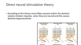 Recent advances in management of dental hypersensitivity | PPTX