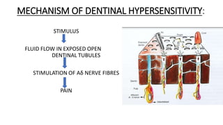 Recent advances in management of dental hypersensitivity | PPTX