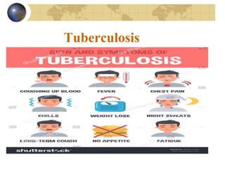 Recent advances in management of tuberculosis final | PPTX