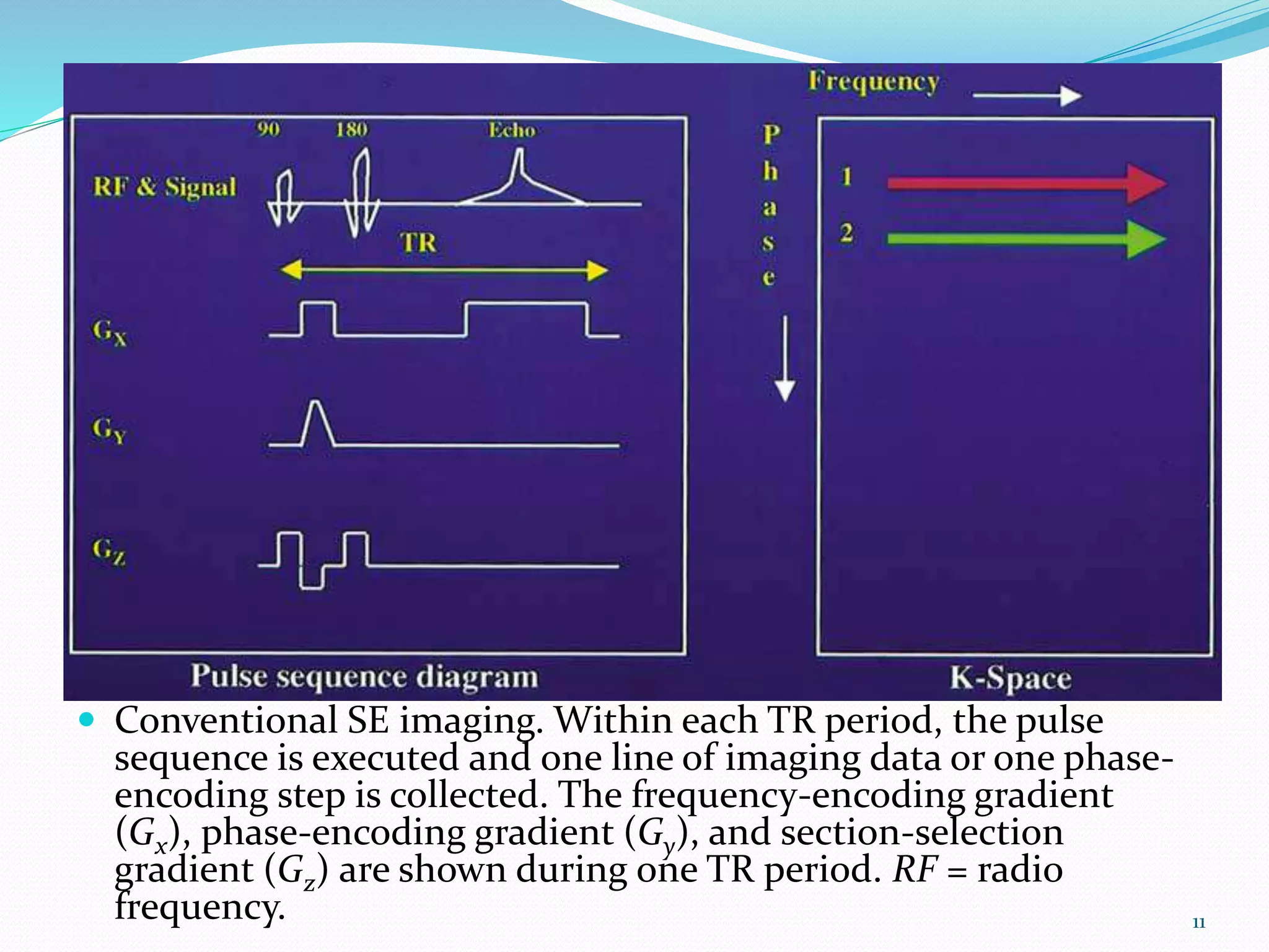 Recent Advances In MRI | PPTX