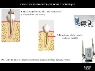 Recent advances in obturation techniques/ dental implant courses | PPT
