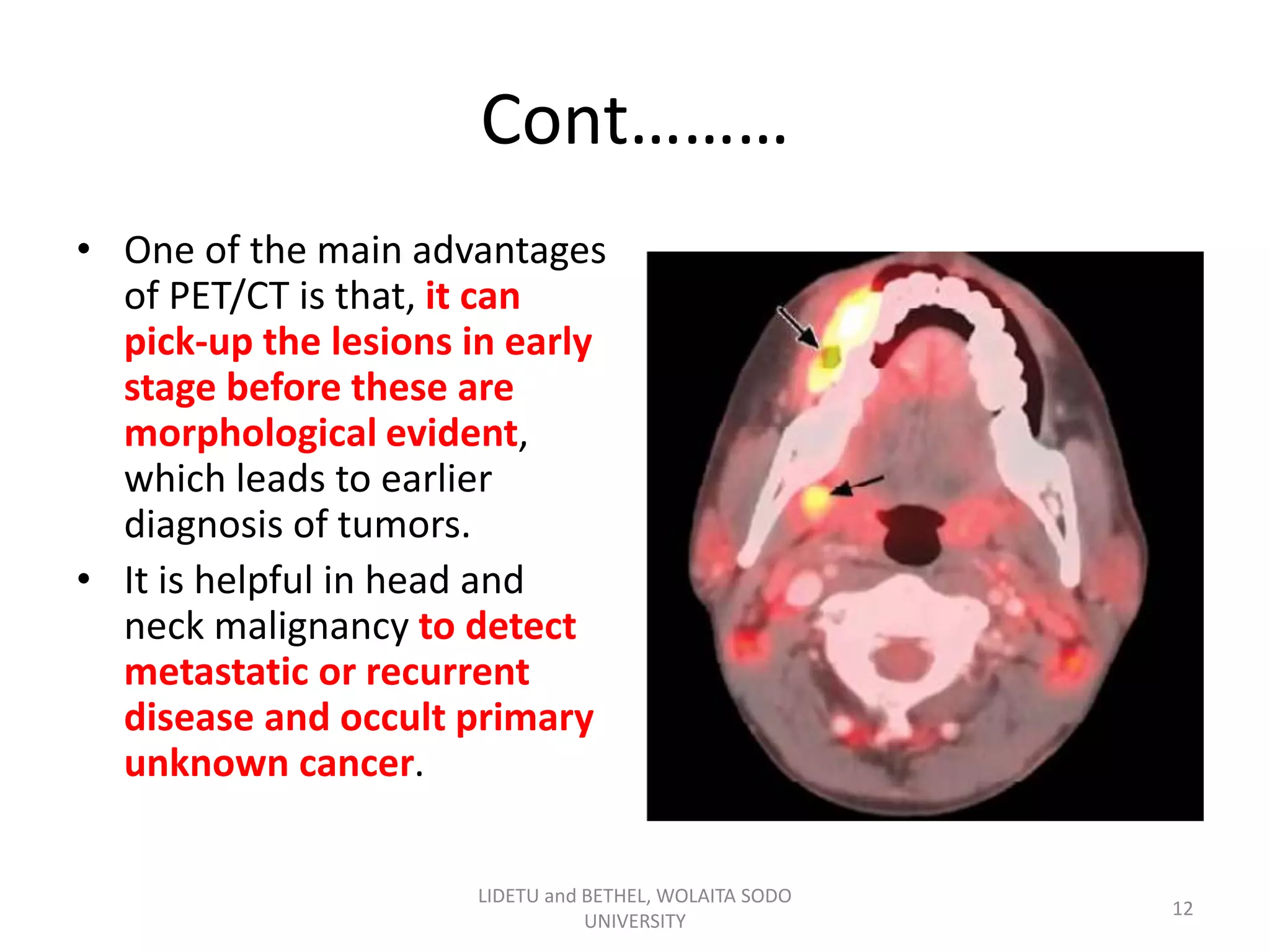 Recent and Latest Advances in Oral and Maxillofacial surgery, Dr ...