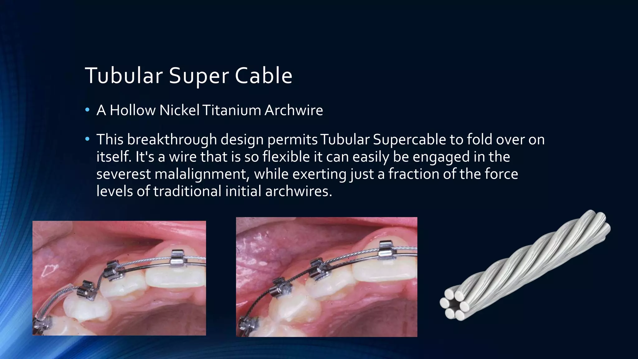 Recent advances in orthodontic archwires | PPTX