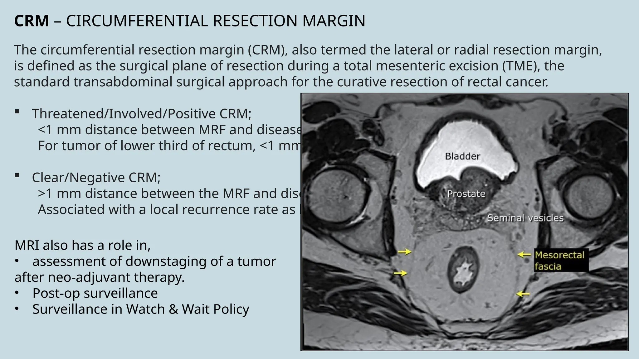 Recent Advances in Radiation Therapy for Rectal Cancer.pptx