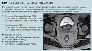 Recent Advances in Radiation Therapy for Rectal Cancer.pptx