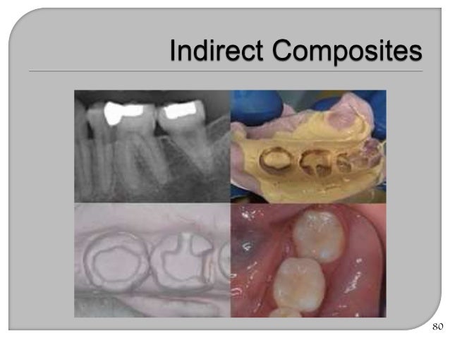 Resin based composites(Recent Advances)