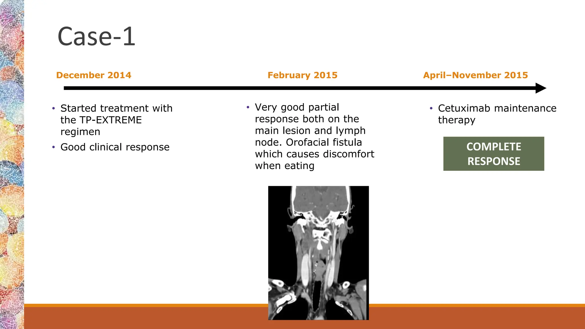 Recent advances in RM Head & Neck cancer (1) (2).pptx