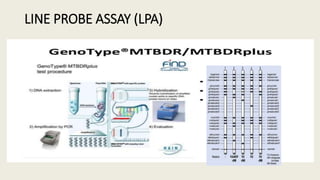 Recent advances in TB diagnosis | PPTX