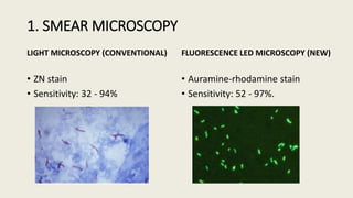 Recent advances in TB diagnosis | PPTX