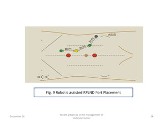 Recent advances in the management of testicular tumor | PPTX