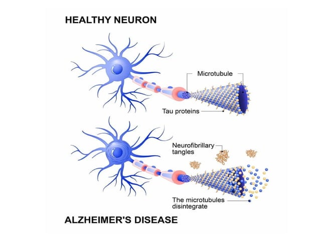 RECENT ADVANCES IN THE PHARMACOTHERAPY OF ALZHEIMER’S DISEASE.pptx