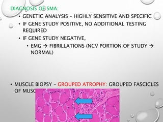 Recent advances in the sma | PPTX