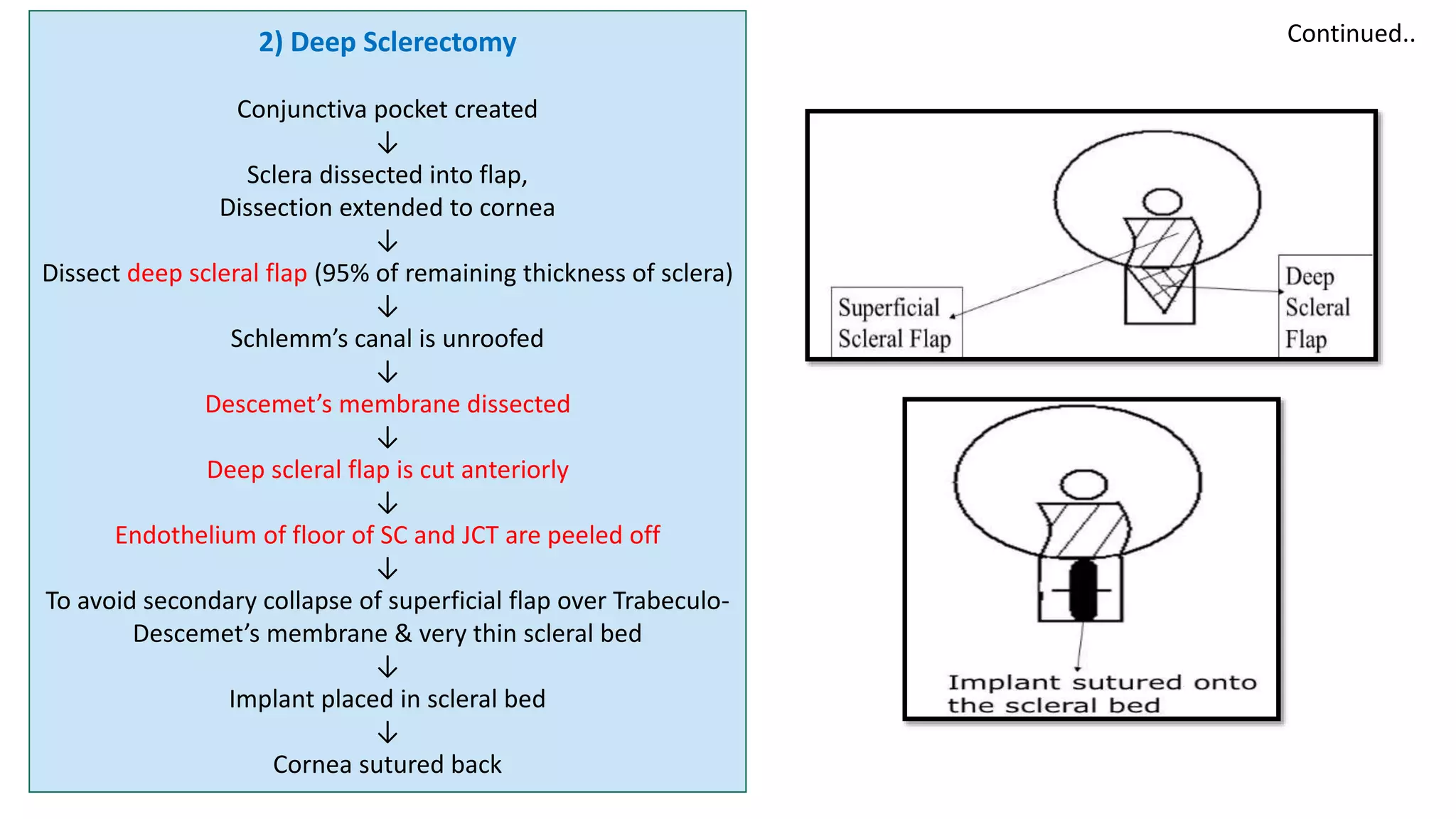 Recent advances in the treatment of glaucoma.pptx