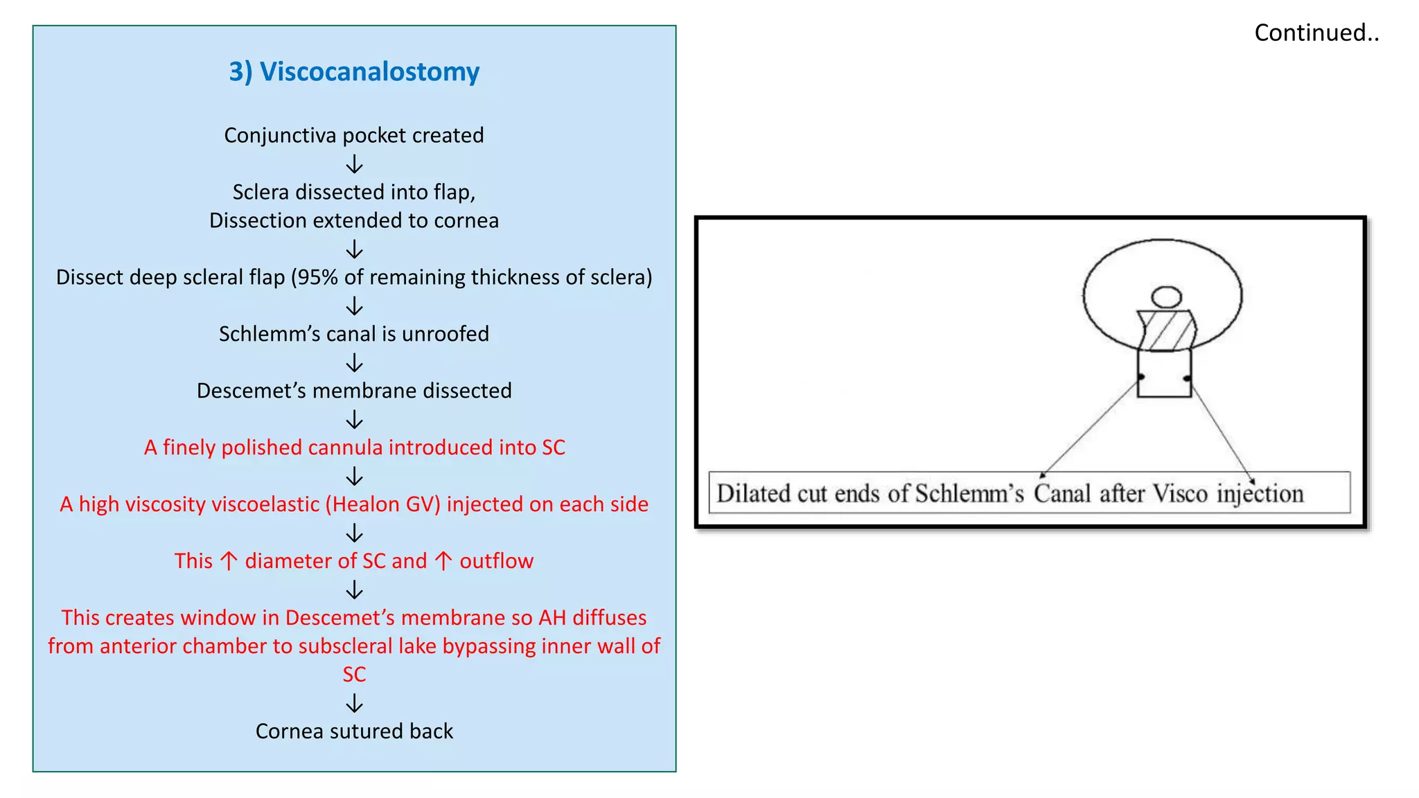 Recent advances in the treatment of glaucoma.pptx