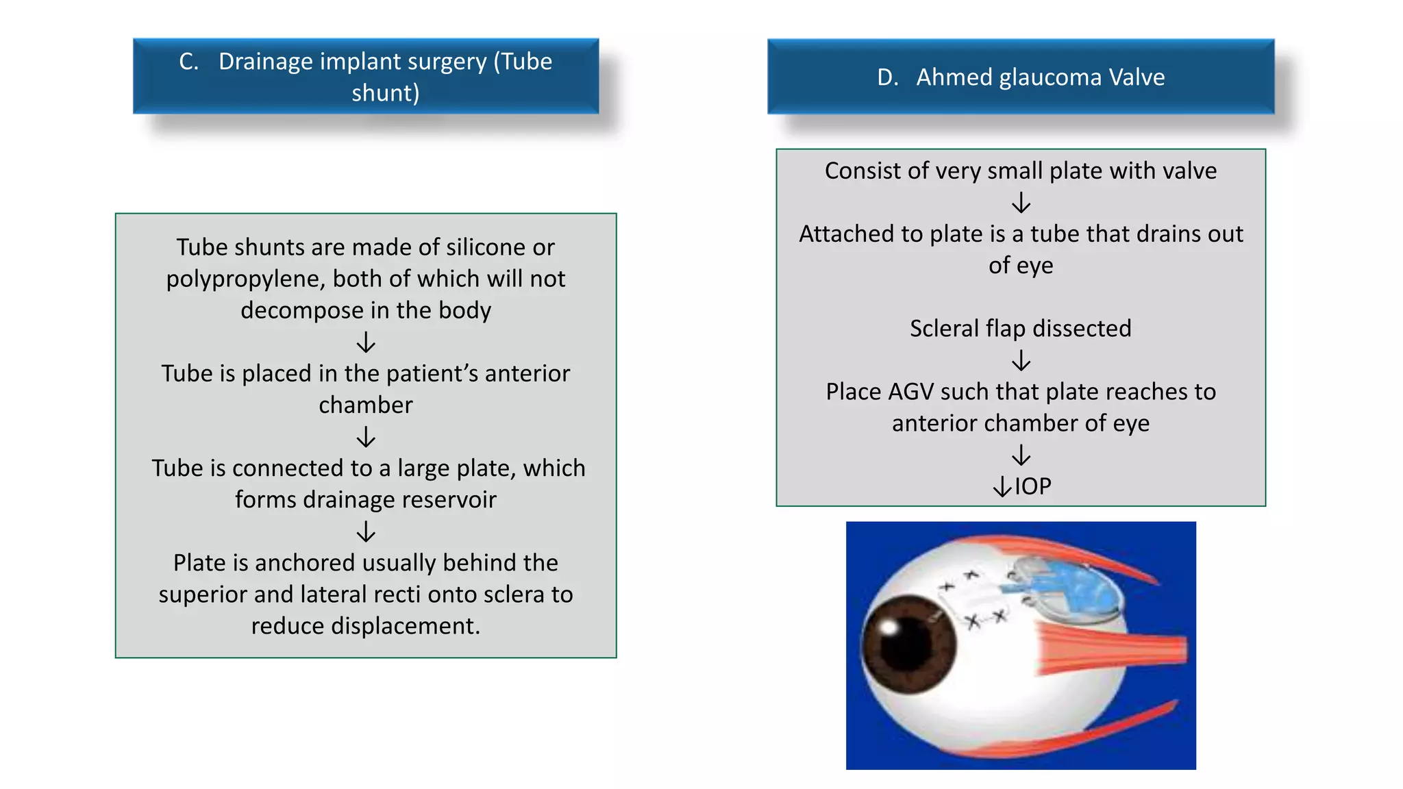 Recent advances in the treatment of glaucoma.pptx