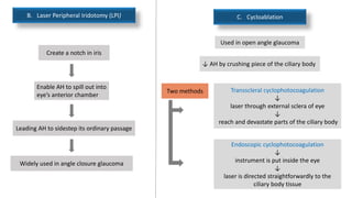 Recent advances in the treatment of glaucoma.pptx
