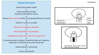 Recent advances in the treatment of glaucoma.pptx