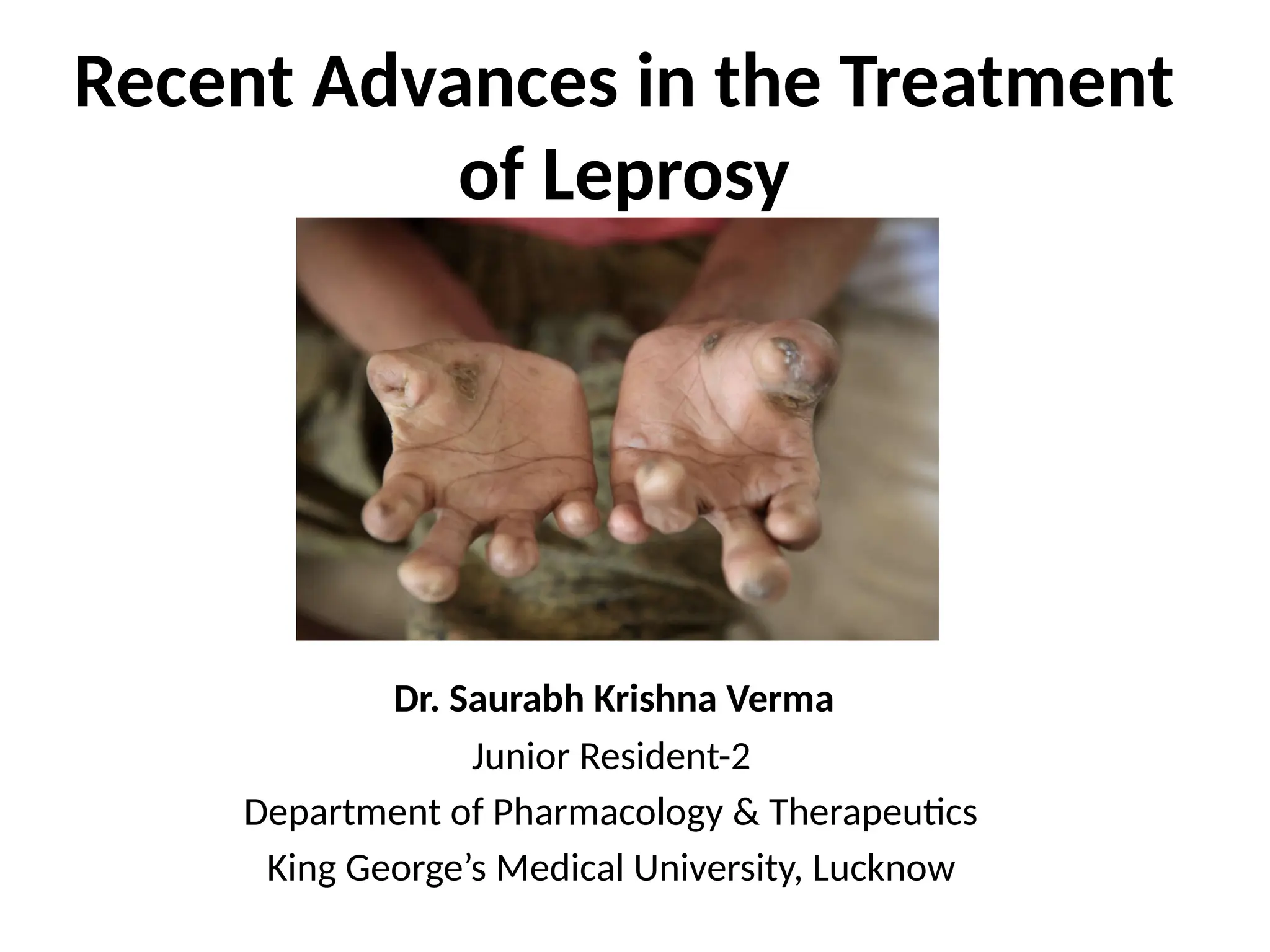 Recent advances in the treatment of Leprosy.pptx