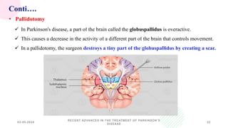 Recent Advances in the treatment of Parkinson's Disease.pptx