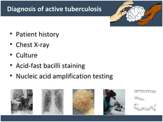 Recent advances in tuberculosis | PPT