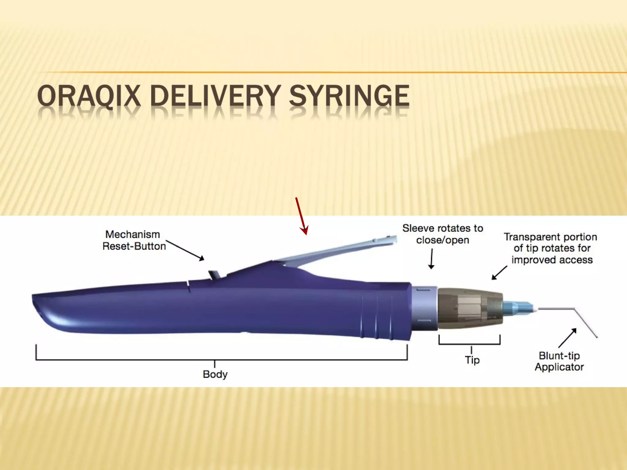 Recent Advances in local Anaesthesia in dentistry | PPT