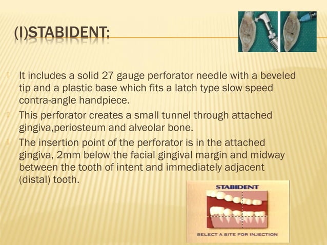 Recent Advances in local Anaesthesia in dentistry | PPT | First Aid ...