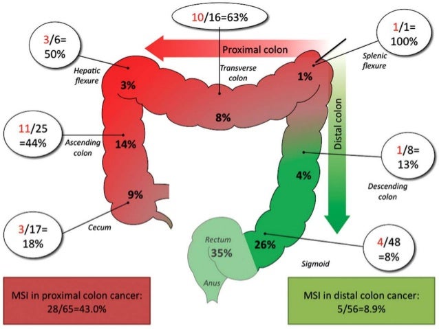 Recent advances on colo rectal carcinoma1