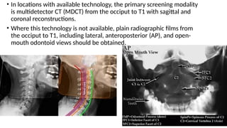 RECENT BOARD GUIDELINES FOR MANAGEMENT OF SPINAL INJURY PATIENT.pptx