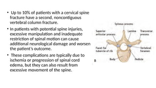 RECENT BOARD GUIDELINES FOR MANAGEMENT OF SPINAL INJURY PATIENT.pptx