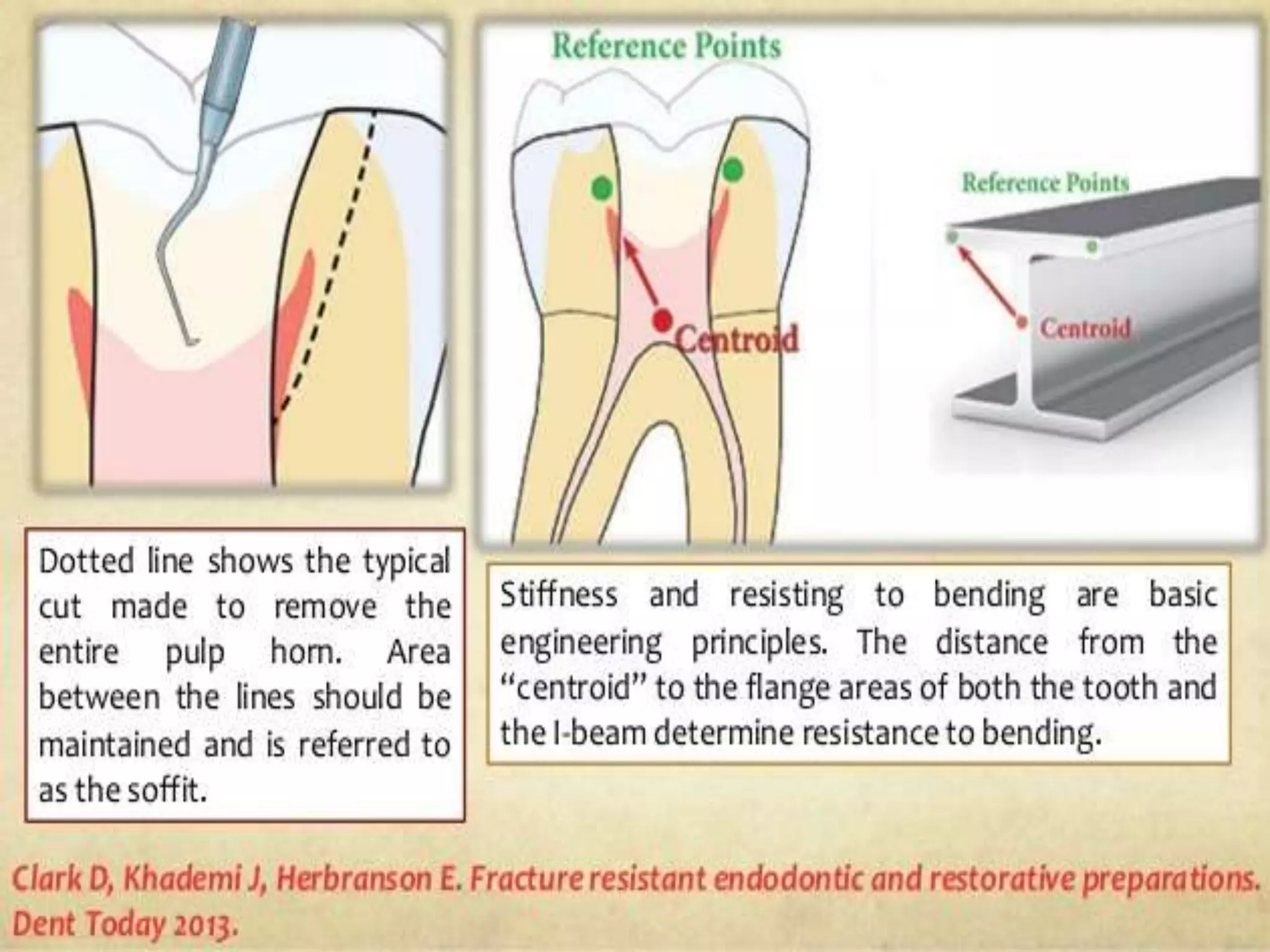 Recent concepts in post endodontic restorations | PPTX