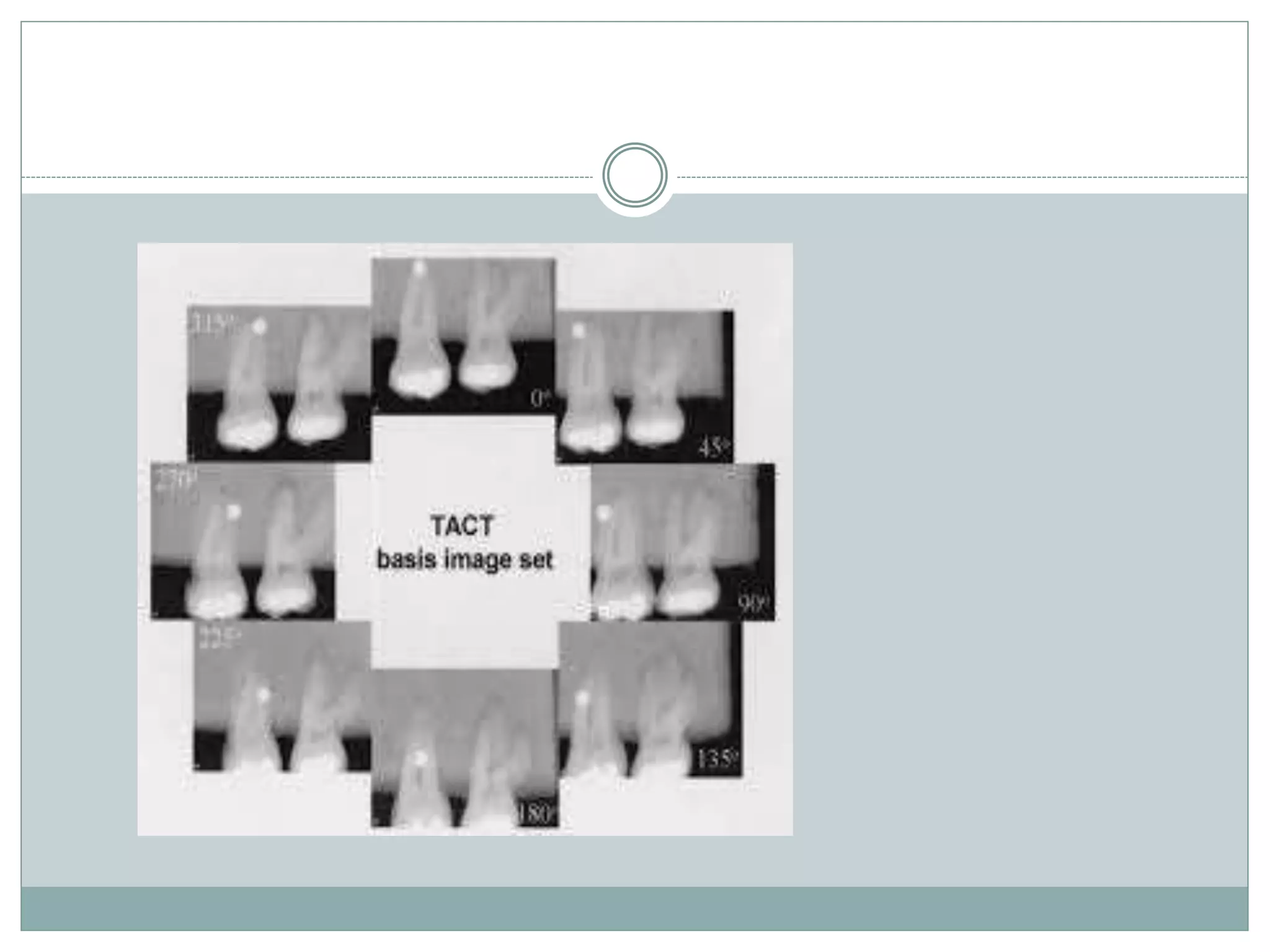 Recent diagnostic aids in endodontics | PPTX