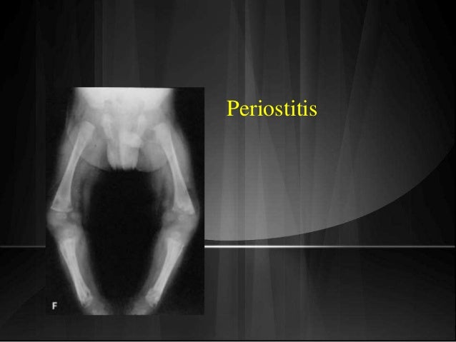 atypical neonatal infection