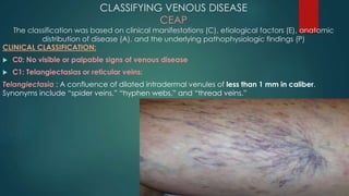 Recent management of primary varicose veins | PPTX