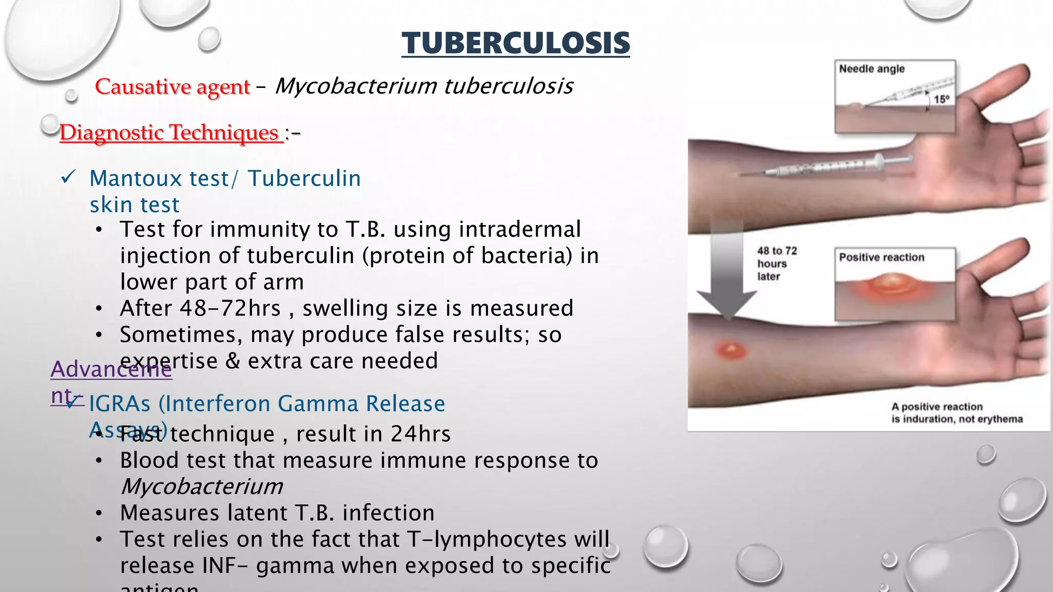recent microbial techniques & advancement in identifying, cultivating ...