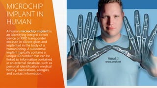 Advanced Biometrics - Microchip implantation in Human | PPTX